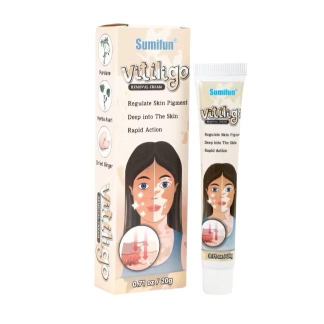 Salep vitiligo Obat vitiligo untuk kulit bercak putih, jerawat - Shop ...