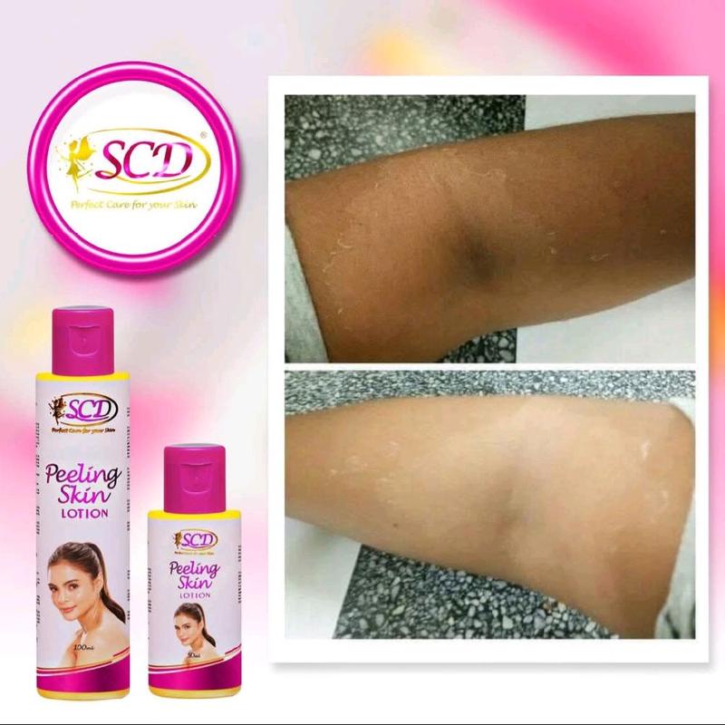 SCD Skin Peeling Lotion 100ml Whitening exfoliating removes dark ...