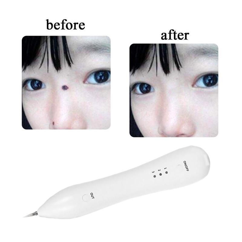 Beauty Spot Pen mesin laser serbaguna buang kutil ketuat bintik ...