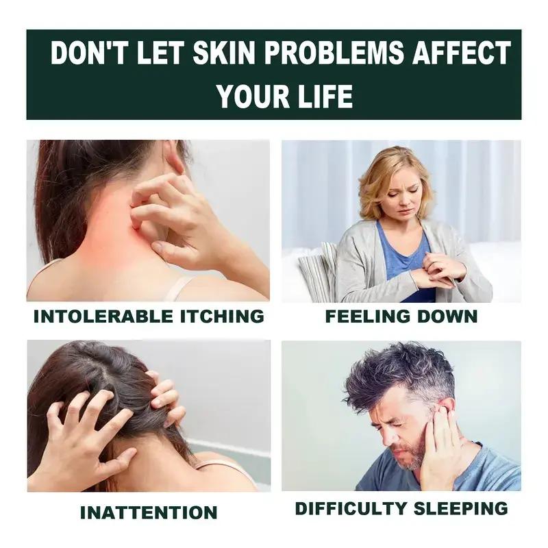 Salep Gatal Salep Psoriasis Cepat dan Efektif Obat Gatal Pantat Dan ...