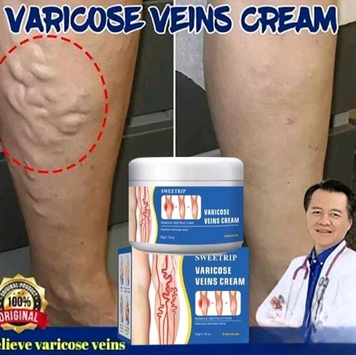 KRIM VARISES / VARICOSE VEINS CREAM 50gr varian biru Tubuh - Shop ...