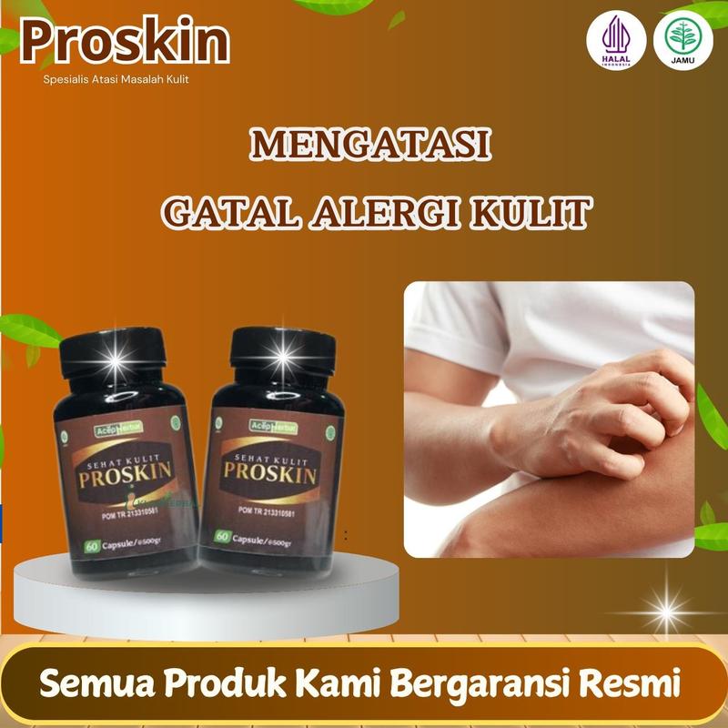 Proskin Gatal Alergi Kulit Biduran Kaligata Ruam Bintik Mera - Shop ...