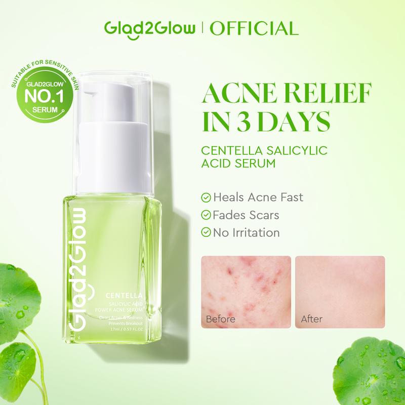 Glad2Glow Centella & Salicylic Acid Acne Serum | Fast Acne Treatment ...