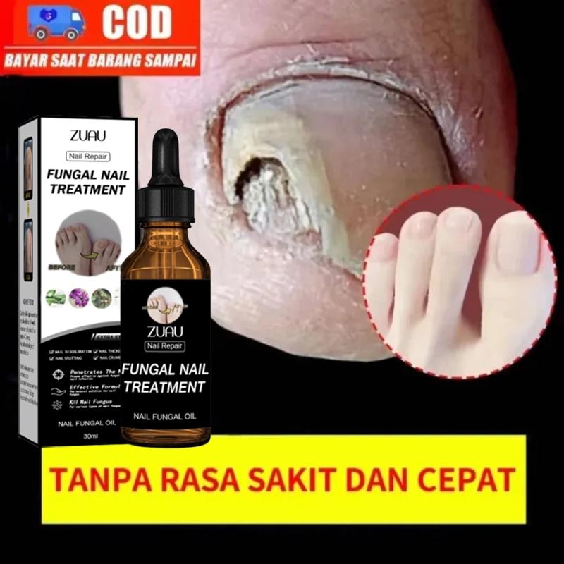 Nail Repair Essence Serum Original Serum Kuku Perawatan Kuku - Shop ...