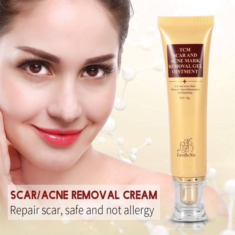 LANBENA CREAM Menghilangkan Parut Jerawat Menyembuhkan luka melecur ...