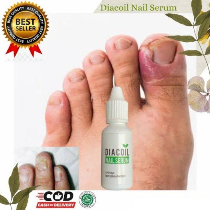DIACOIL NAIL SERUM ORIGINAL SOLUSI PENGHILANG MASALAH SAKIT KUKU - Shop ...
