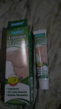 Krim Obat Lipoma Sol lora 20g BPOM Original untuk Mengatasi Benjolan - Shop | Tokopedia