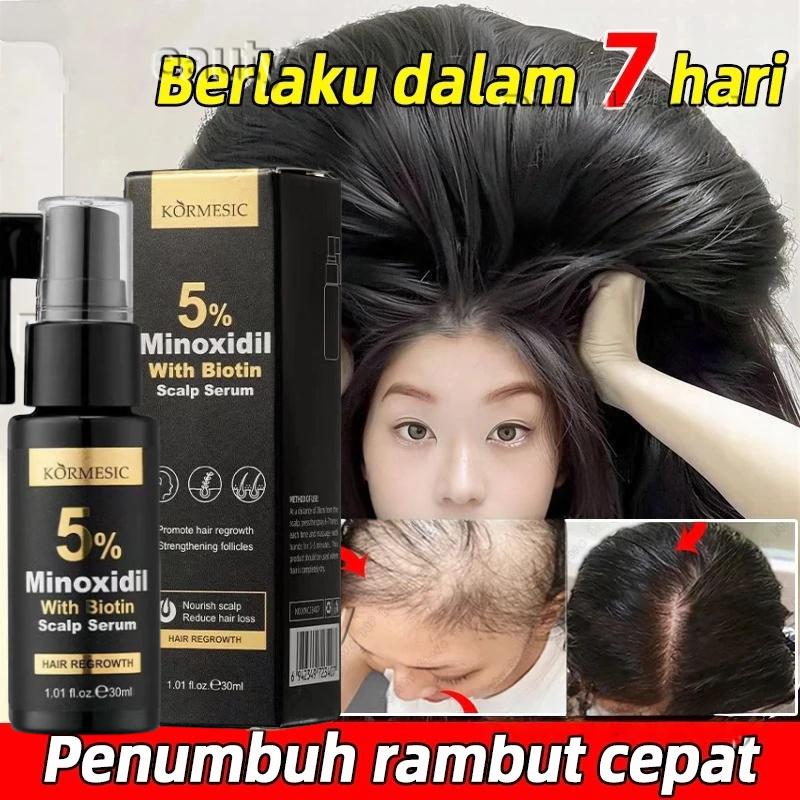 Minoxidil 5% Penumbuh Rambut Obat Penumbuh Rambut Botak, Tipis - Shop ...