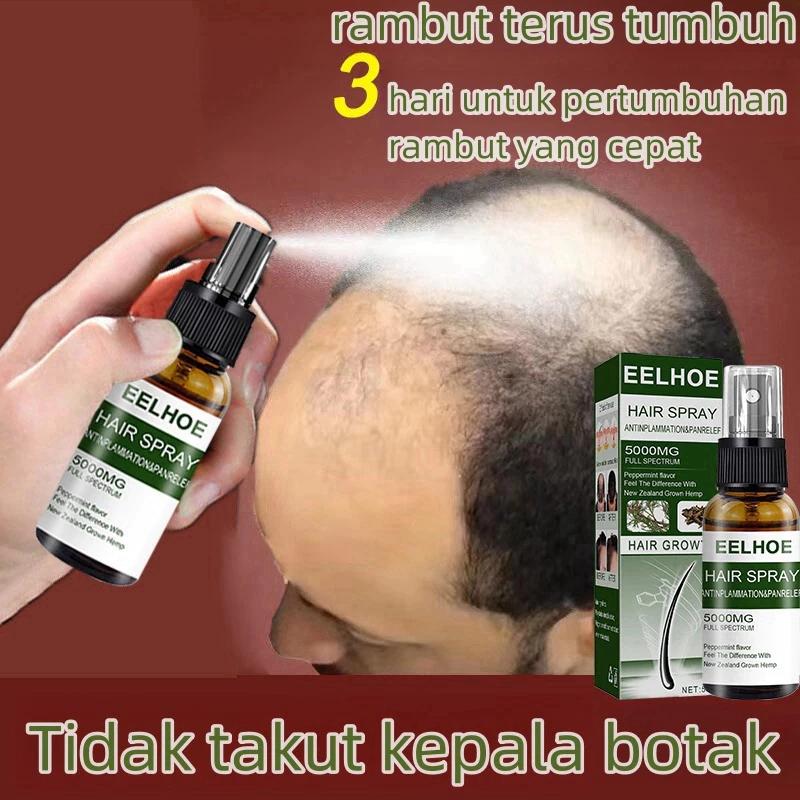 Penumbuh Rambut Botak Semprotan Penumbuh Rambut Obat Rambut Botak Serum ...