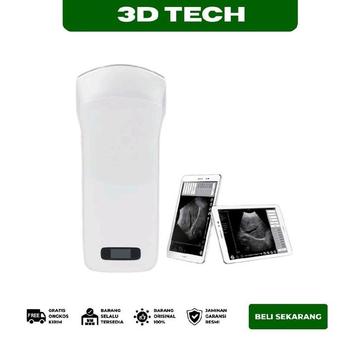 Jual USG Wireless/WiFi (ECHO Ultrasound) (linear+Cardiac Sector Probe ...