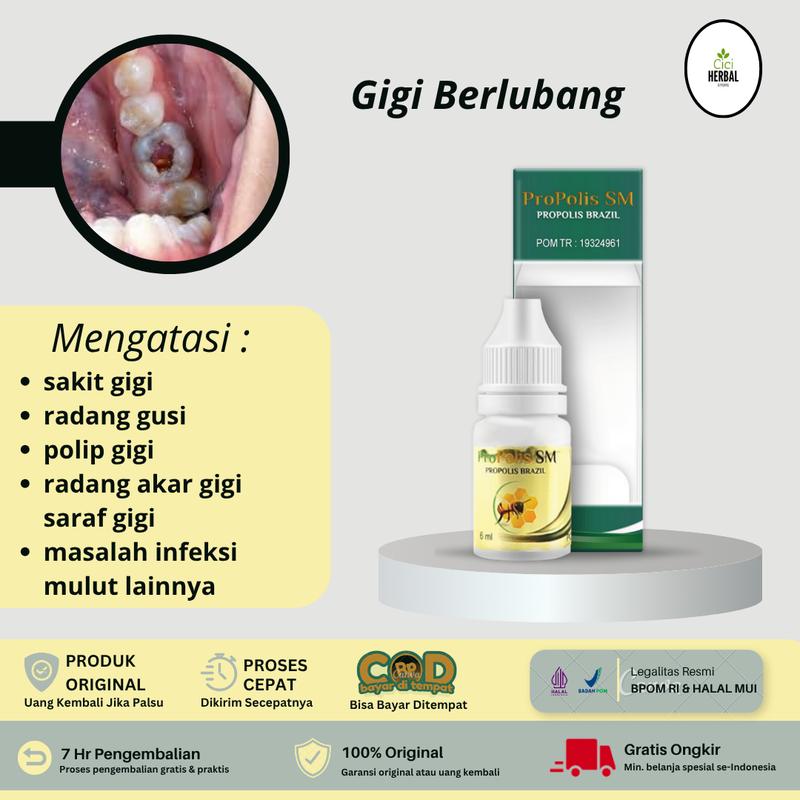 ProPolis SM - Gigi Berlubang, Gigi Bolong Tumbuh Daging, Gusi Bengkak ...