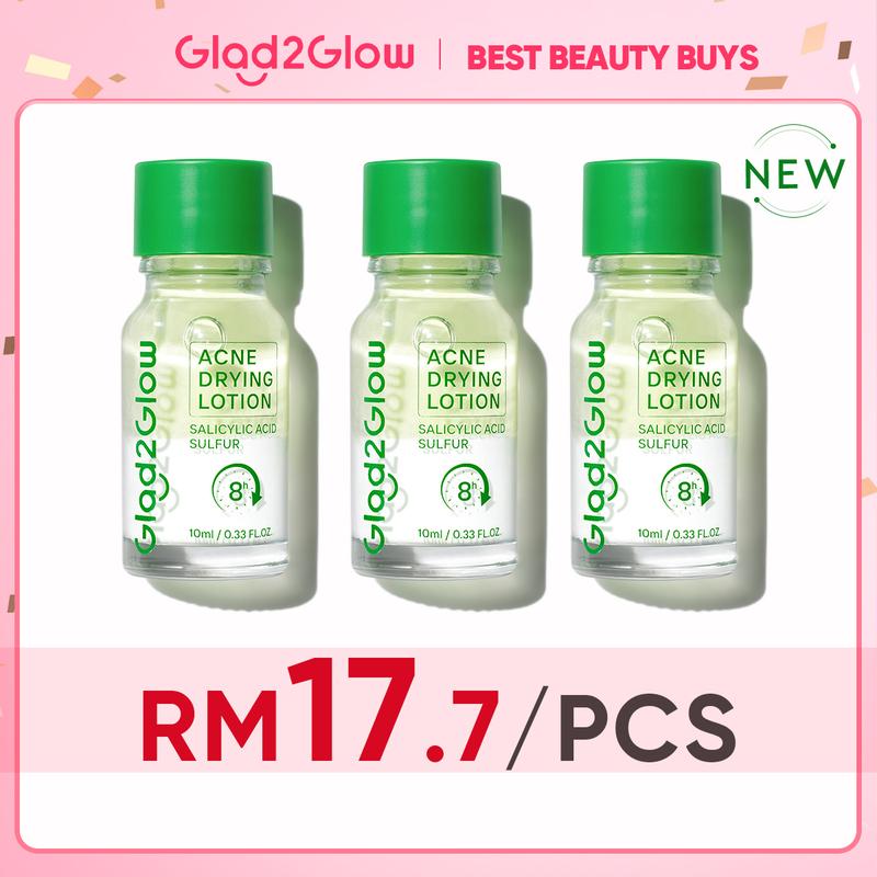G2G 3PCS- Glad2Glow Acne Drying Lotion 10 ml Calms Acne Soothes ...