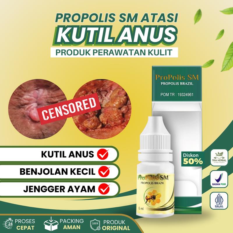 Propolis SM Perawatan Atasi Kutil di Anus, Daging Jadi, Benjolan - Shop ...