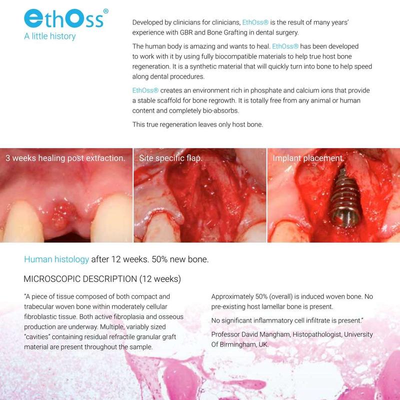 EthOss Bone Graft 1.0cc (3 Syringes) - Shop | Tokopedia