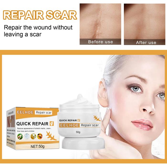Jual Eelhoe Repair Scar Quick Repair Surgical Scar Repair Cream ...
