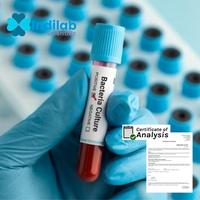 Jual Kultur Murni Bakteri Prevotella Intermedia New Best Quality 100% ...