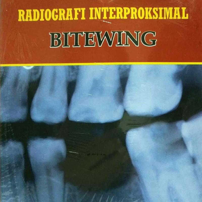 Radiografi Interproksimal BITEWING DISCOUNT 30% - Shop | Tokopedia